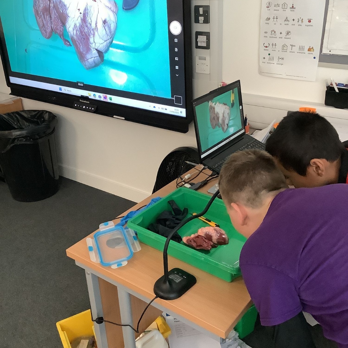 Dosthill Primary Academy - Year 6 Explore Circulatory System with Sheep ...